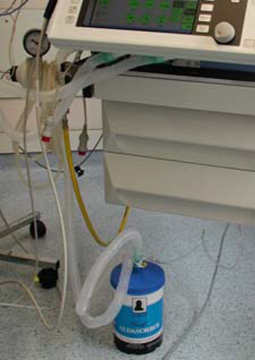 Sedierung mit volatilen Anästhetika auf der Intensivstation | SpringerLink