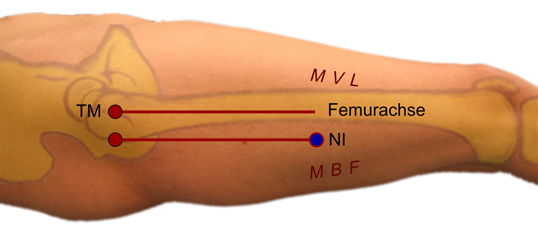 Periphere Nervenblockaden an der unteren Extremität | SpringerLink