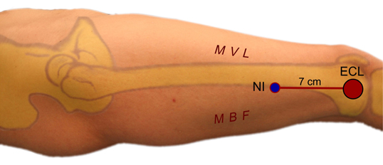 Periphere Nervenblockaden an der unteren Extremität | SpringerLink