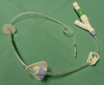 Endoskopische und chirurgische Techniken zur enteralen Ernährung ...