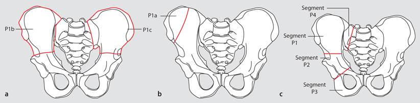 Osteo- und Chondrosarkome des Beckens und der unteren Extremitäten ...