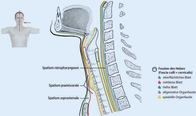 Therapie der akuten Mediastinitis | SpringerLink