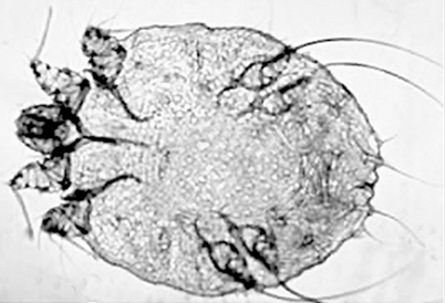 Skabies | SpringerLink