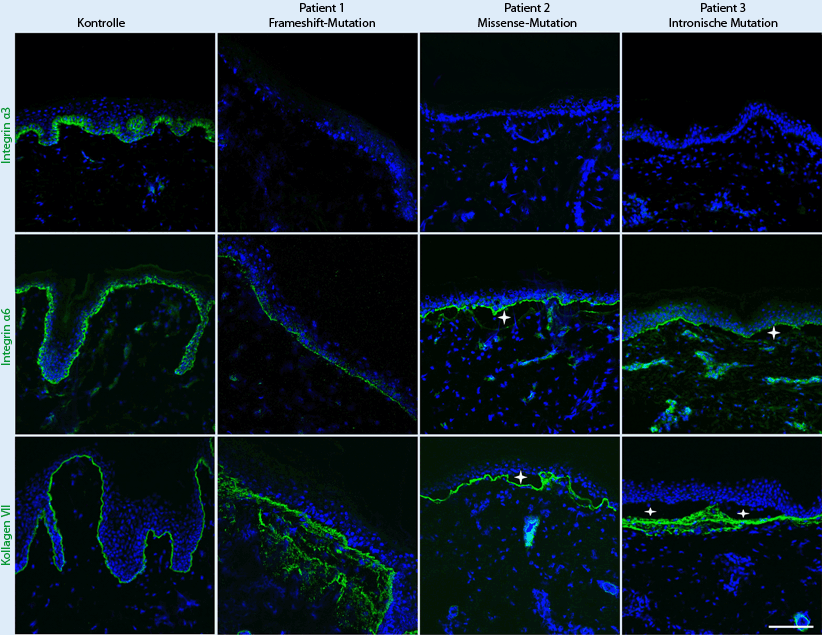 Praktische Aspekte der molekularen Diagnostik bei Genodermatosen ...