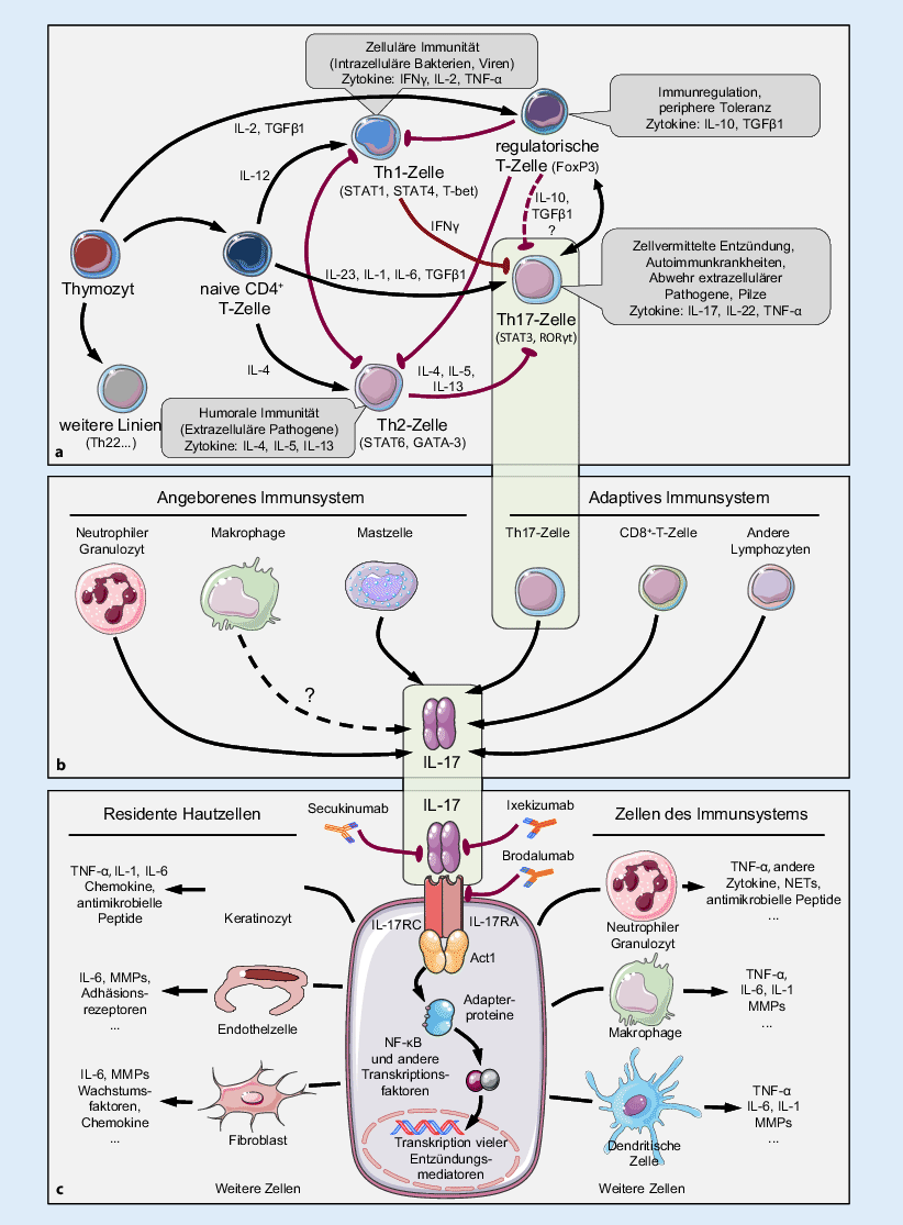 Pathogenese der Psoriasis vulgaris | SpringerLink