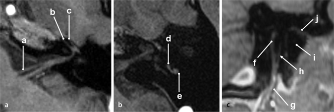 Computer- und Magnetresonanztomographie des N. facialis | SpringerLink