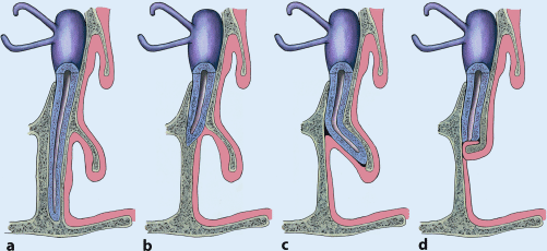Anatomie und Physiologie der ableitenden Tränenwege | SpringerLink