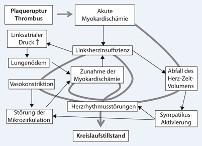 Therapie des kardiogenen Schocks bei akutem Herzinfarkt | SpringerLink