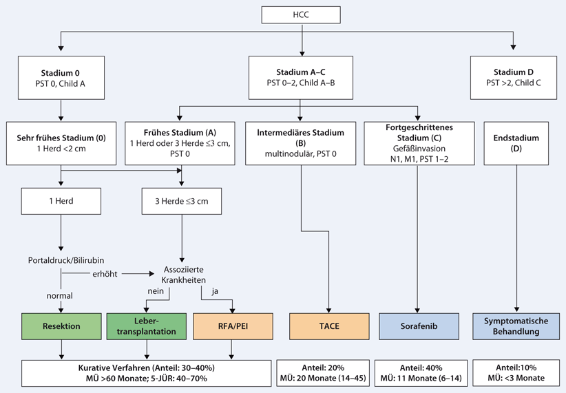 Therapie des hepatozellulären Karzinoms | SpringerLink