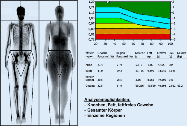 Kachexie und Sarkopenie bei chronischer Herzinsuffizienz | SpringerLink