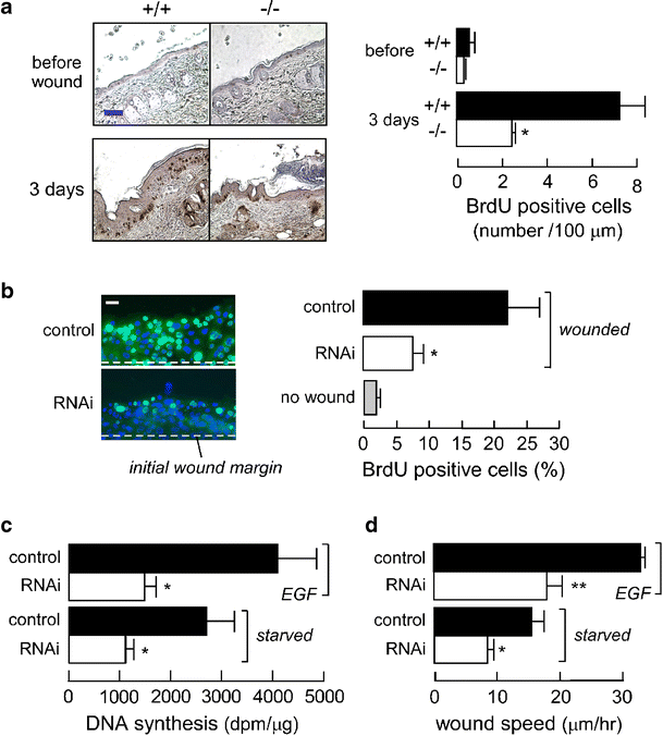 Aquaporin-3 facilitates epidermal cell migration and proliferation ...