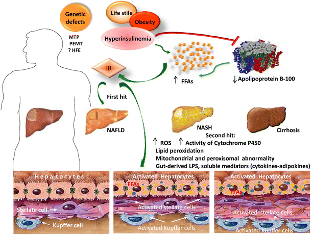 Molecular mechanisms involved in NAFLD progression | SpringerLink