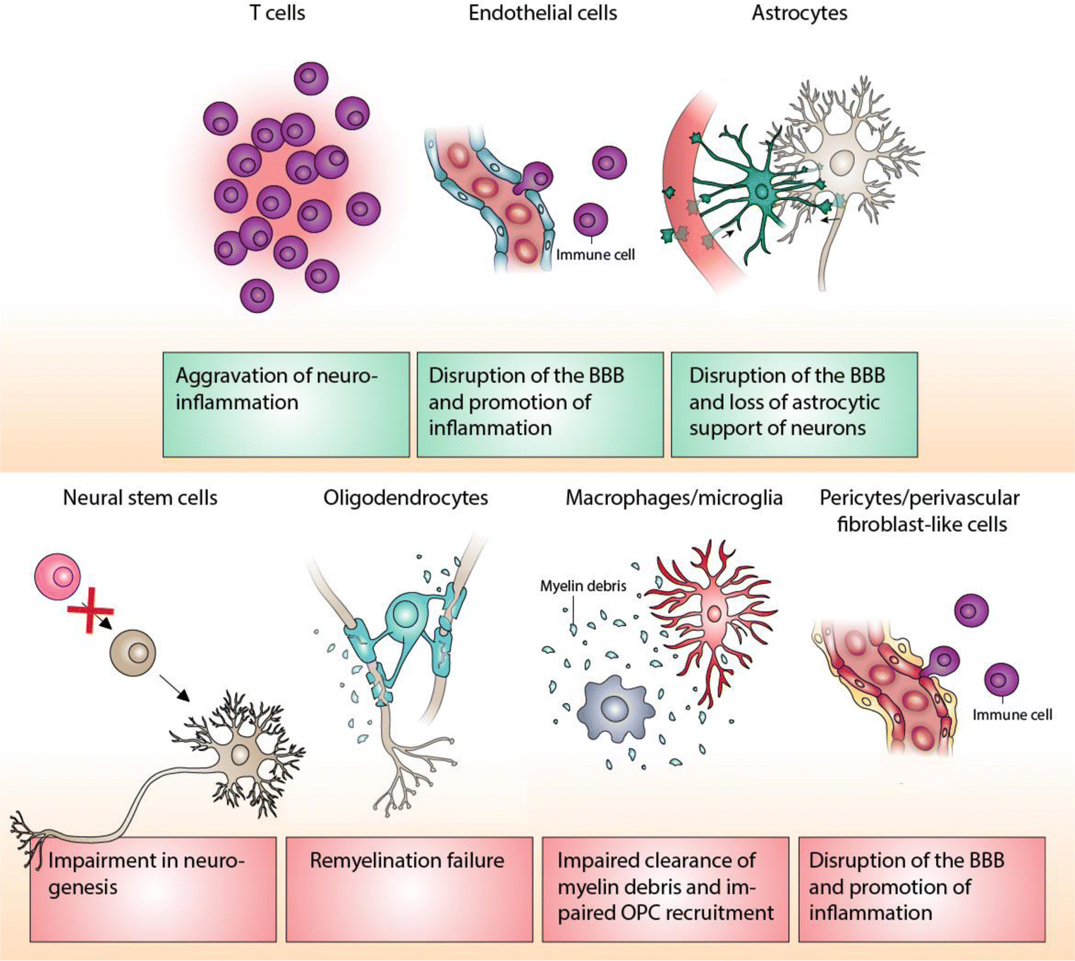 Targeting senescence to delay progression of multiple sclerosis ...