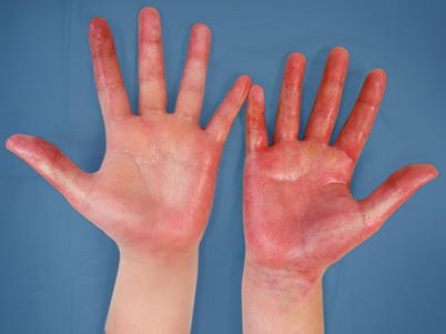 Pulver, weiß und fein wie Mehl, aber ätzend | SpringerLink