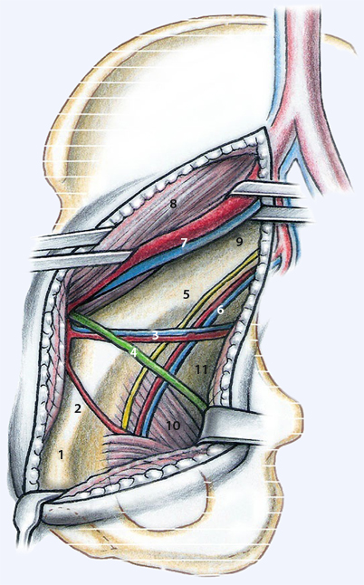 Anteriore Zugänge zum Acetabulum | SpringerLink