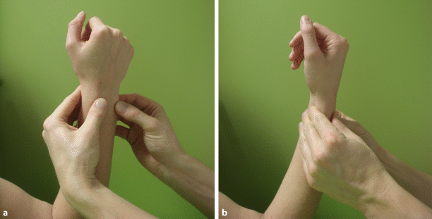 Carpus und distales Radioulnargelenk | SpringerLink