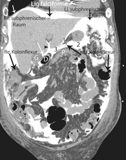 Peritoneum und Mesenterium | SpringerLink