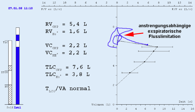 Lungenfunktion | SpringerLink
