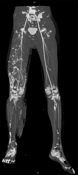 Polytrauma-Computertomographie | SpringerLink