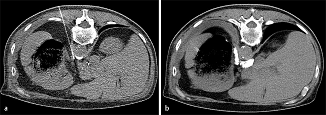 Ganglienblockade | SpringerLink