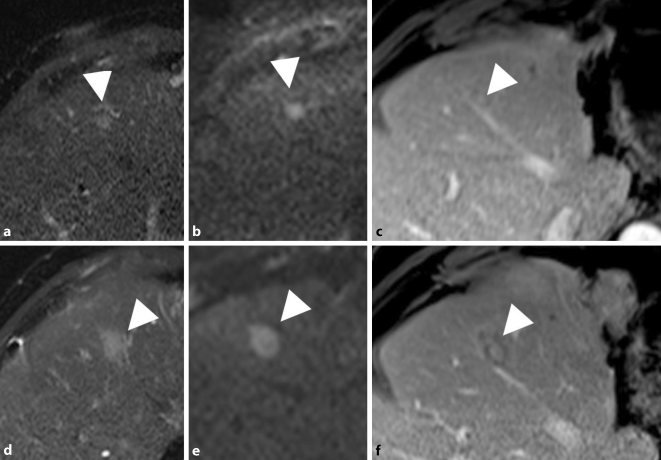 CT und MRT der Leber: wann, was, warum? | SpringerLink