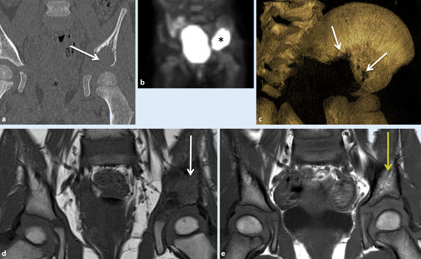 Postoperative und posttherapeutische Veränderungen nach primären ...
