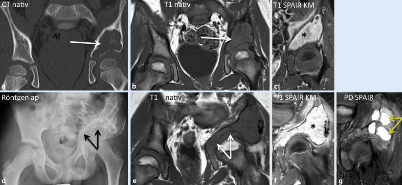 Postoperative und posttherapeutische Veränderungen nach primären ...