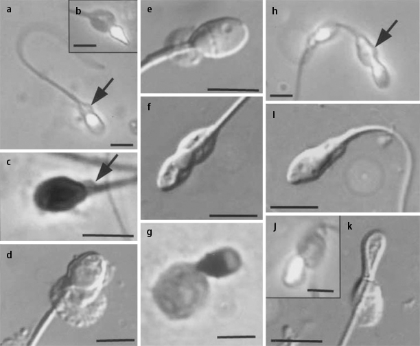 Ejakulatdiagnostik | SpringerLink