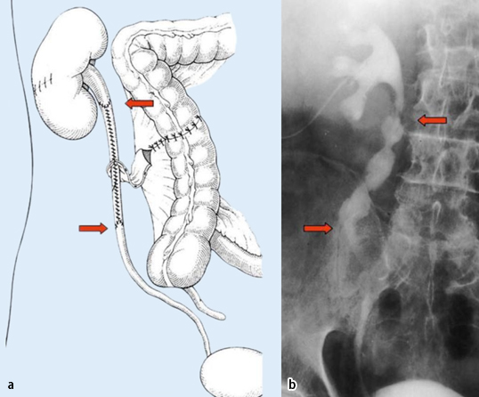 Komplikationsvermeidung und -management bei offenen ...