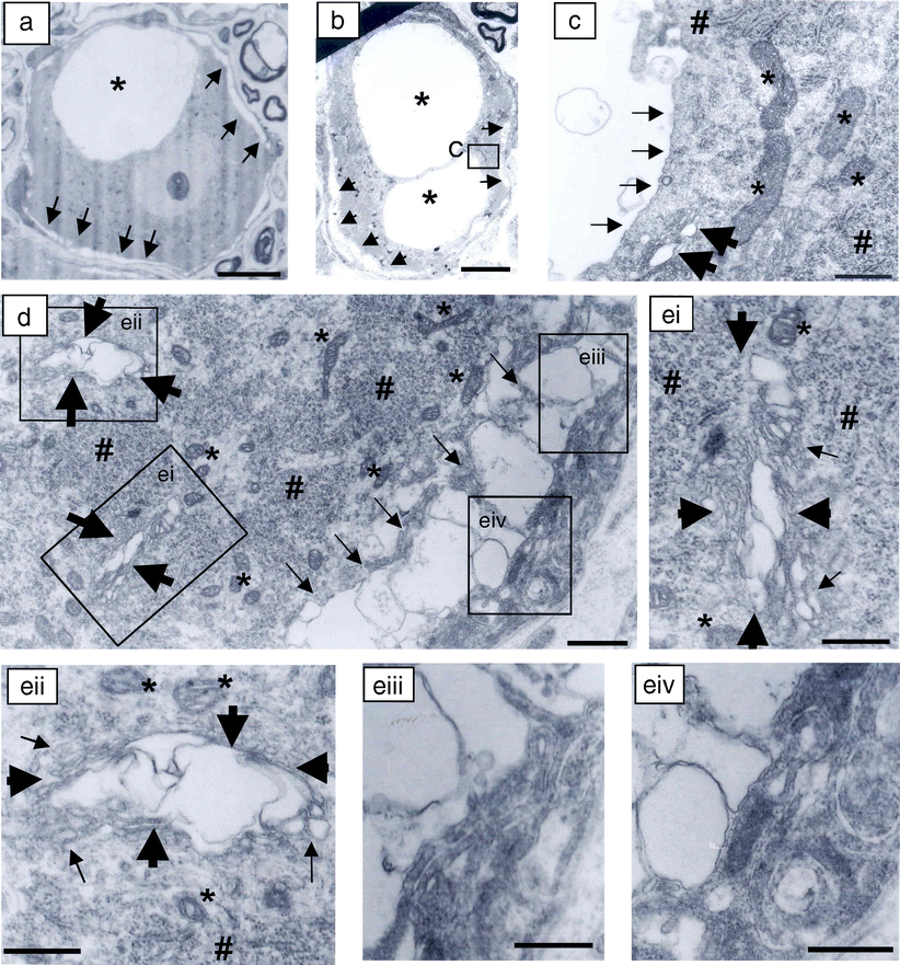 Degeneration of the Golgi and neuronal loss in dorsal root ganglia in ...