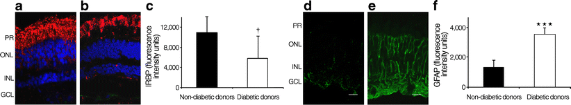 Interphotoreceptor retinoid-binding protein (IRBP) is downregulated at ...