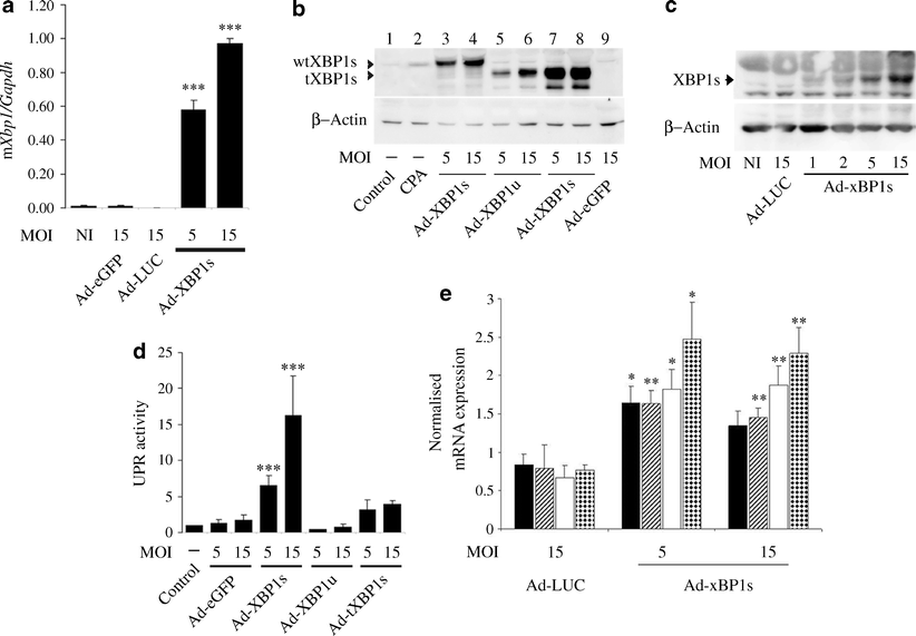 Sustained production of spliced X-box binding protein 1 (XBP1) induces ...