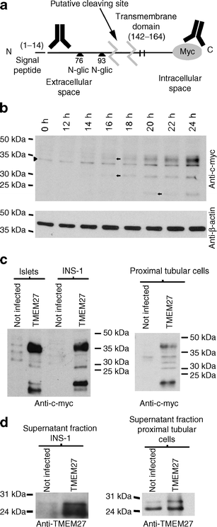 The role of transmembrane protein 27 (TMEM27) in islet physiology and ...