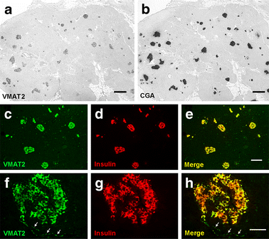 Species-specific vesicular monoamine transporter 2 (VMAT2) expression ...