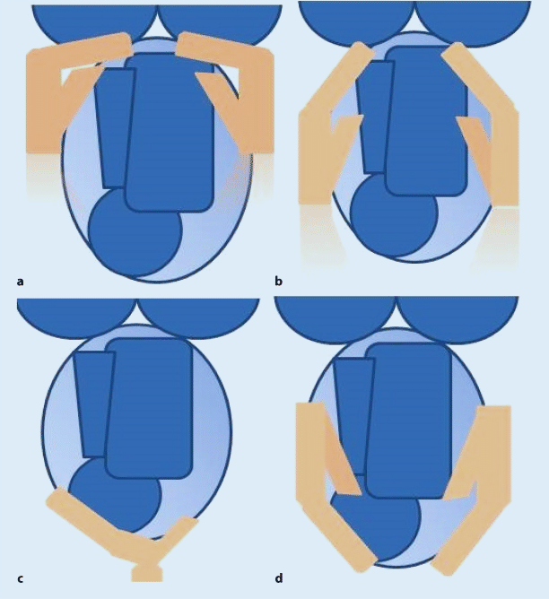 Schwangerenvorsorge | SpringerLink