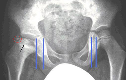 M. Perthes | SpringerLink