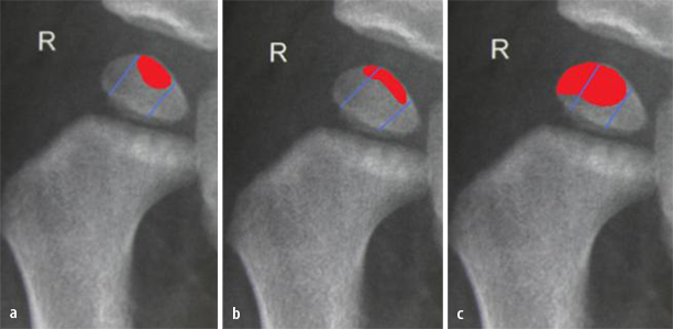 M. Perthes | SpringerLink