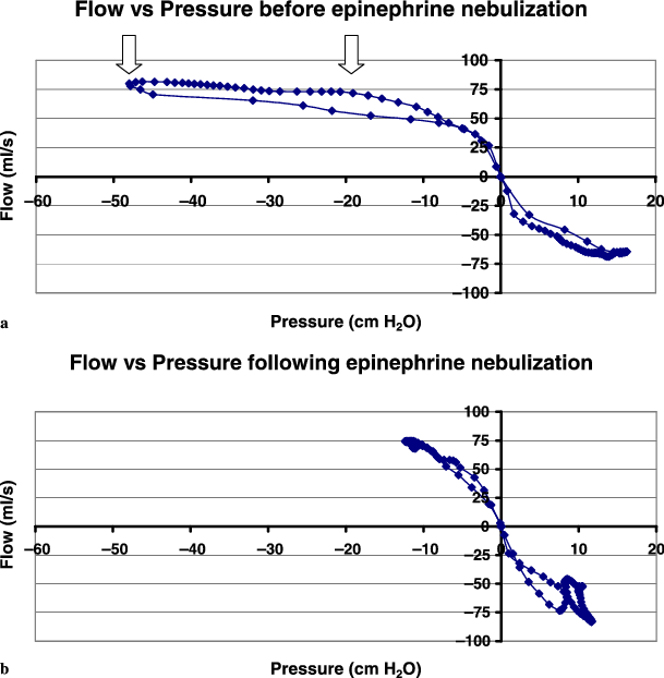 The effect of epinephrine by nebulization on measures of airway ...