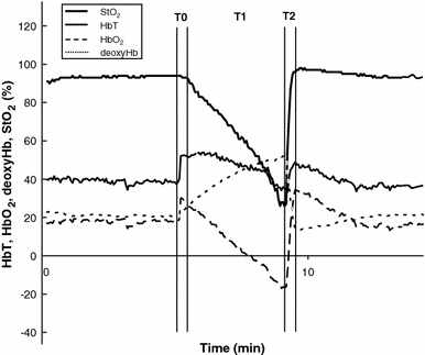 Use of non-invasive NIRS during a vascular occlusion test to assess ...