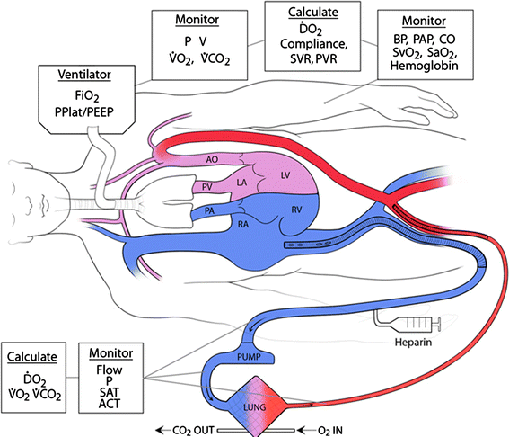 Contemporary extracorporeal membrane oxygenation for adult respiratory ...