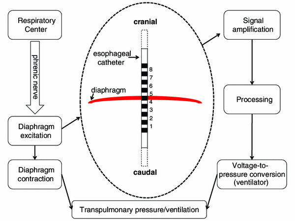 Neurally adjusted ventilatory assist: letting the respiratory center ...
