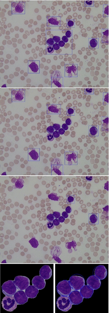 A leucocytes count system from blood smear images | SpringerLink