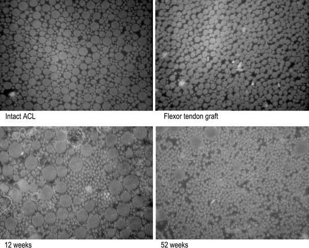 Graft remodeling and ligamentization after cruciate ligament ...