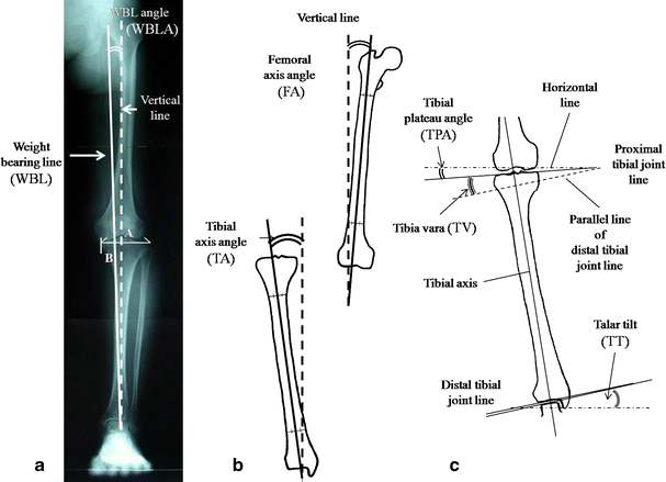 A predictive factor for acquiring an ideal lower limb realignment after ...