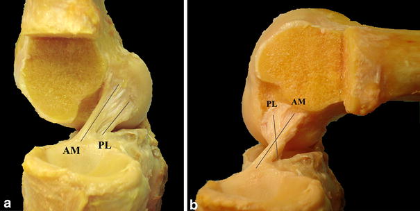 A systematic review of the femoral origin and tibial insertion ...