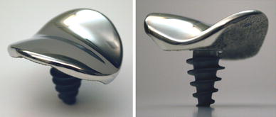 A matched-pair comparison of inlay and onlay trochlear designs for ...