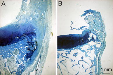 Anatomy of the capsulolabral complex and rotator interval related to ...
