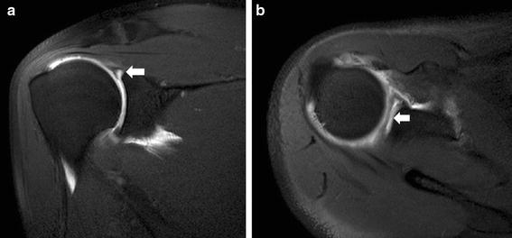 Clinical outcomes of non-operative treatment for patients presenting ...