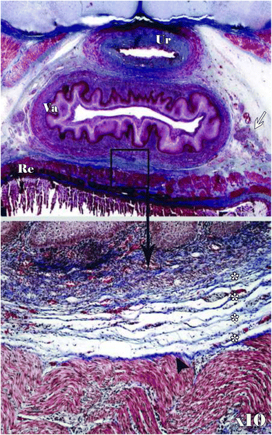 Concepts of the rectovaginal septum: implications for function and ...