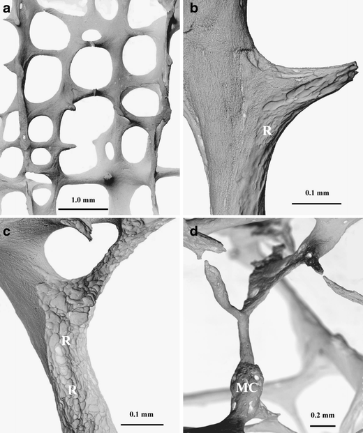 Regional variations of vertebral trabecular bone microstructure with ...